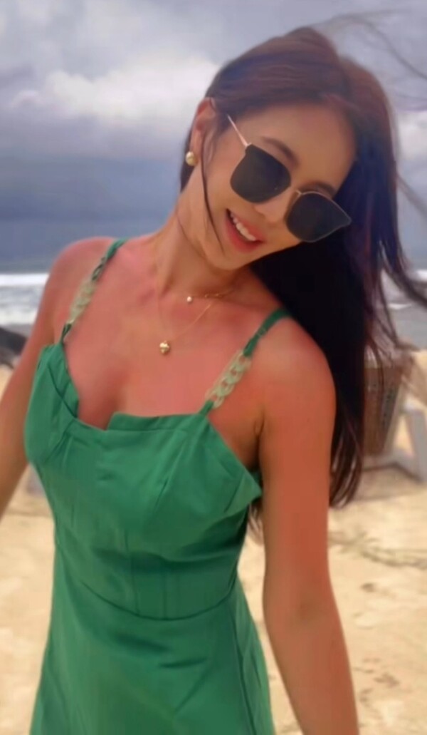 강예빈, 충격 근황 '온몸 화상'…"한국 와서 링거만 3번"